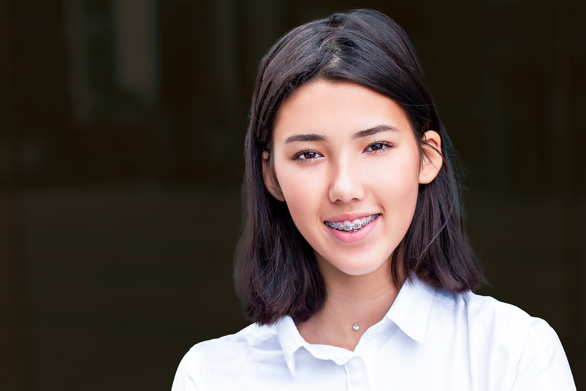 Braces in Karama Dubai - Orthodontic treatment in Karama